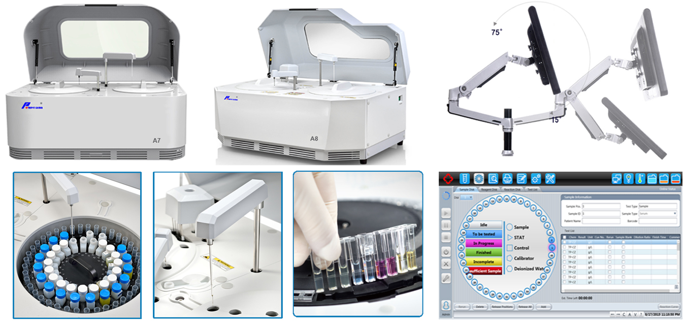 What is automated chemistry analyzer? - Poweam Medical